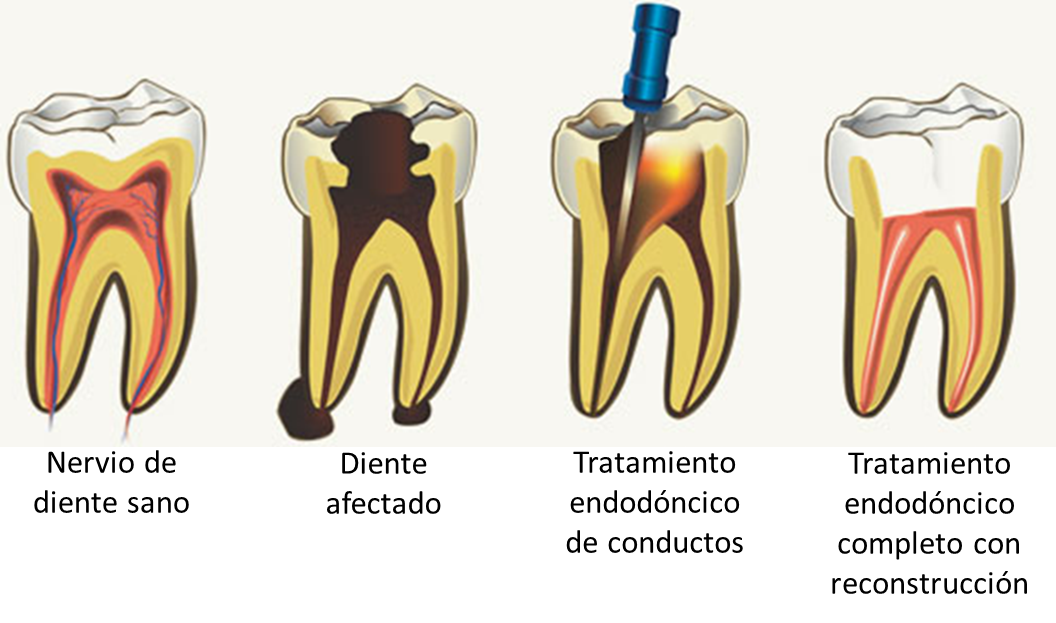 Cómo hay que lavarse los dientes | Urgencias dentales
